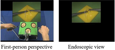 Instructional E Learning Videos For Laparoscopic Suturing And Knot Tying Download Scientific