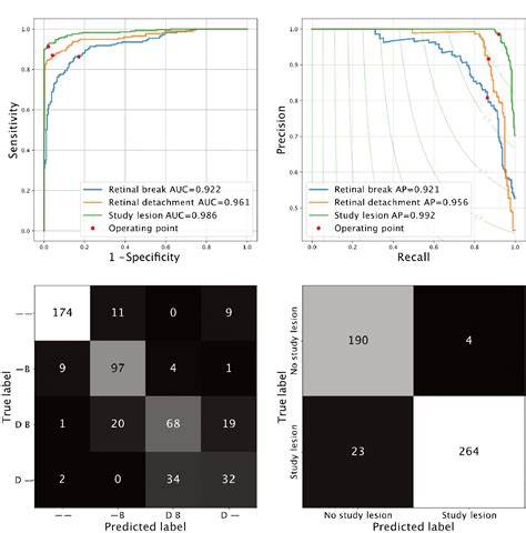 Figure 5 From Deep Learning Based Automated Detection Of Retinal Breaks And Detachments On