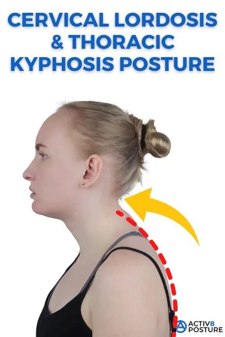 Lordosis Activ8 Posture