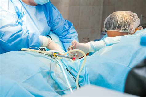 Laparoscopically Assisted Vaginal Hysterectomy