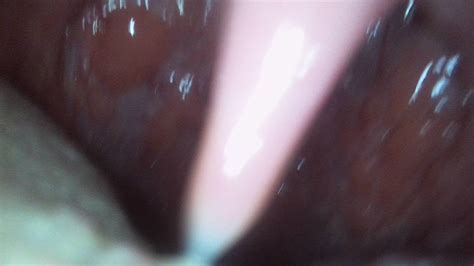 Mouth Tour Endoscope View Thisvid Com