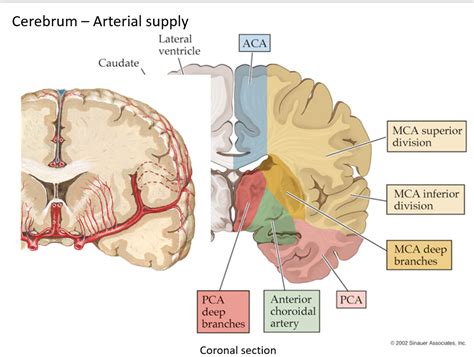 Anterior Choroidal Artery Supply