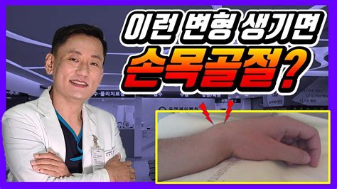 손목 골절의 자가진단 및 치료법 Youtube