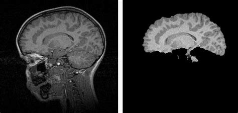 Brain Extraction Sample 1 Download Scientific Diagram