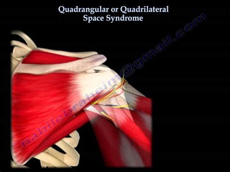 Quadrangular Space Anatomy Human Body Anatomy Anatomy Of Upper Limb