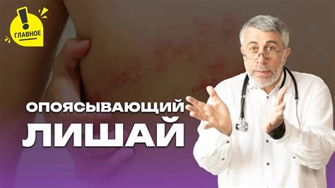 Опоясывающий лишай опоясывающий герпес симптомы и лечение