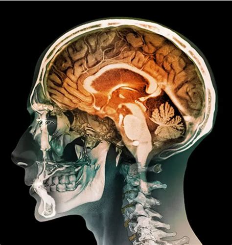 [논문 리뷰] Brain Tumor Classification From Mri Images Using Machine Learning