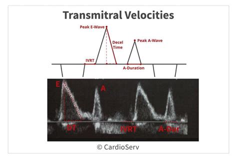 Understanding The Basics Evaluating Diastolic Function Pulmonary