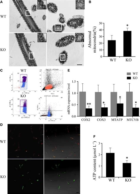 Assessment Of ATP Synthesis In Sperm Of Wildtype WT And Knockout Download Scientific Diagram