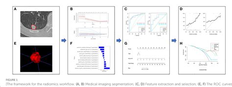 Figure 1 From A Combined Predictive Model Based On Radiomics Features And Clinical Factors For