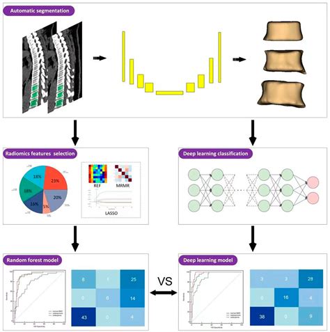 Automatic Osteoporosis Screening System Using Radiomics And Deep Learning From Low Dose Chest Ct