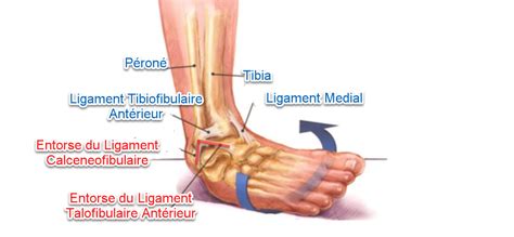 Entorse Cheville Symptômes Causes Traitement Osteomag