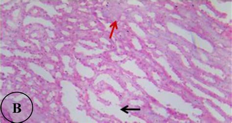 Renal Medulla Tissue Sections Microscopical Images In Different Rat Download Scientific Diagram