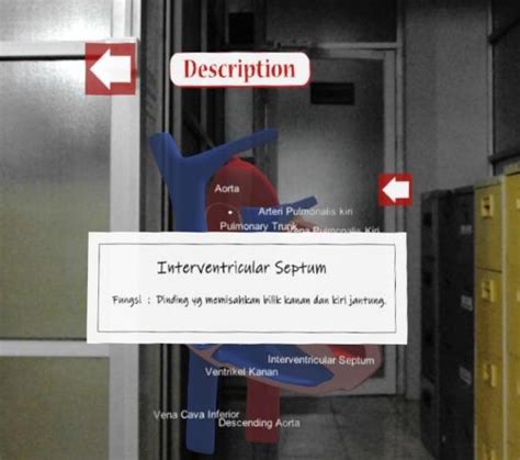 Vsd Description Labels Display Download Scientific Diagram
