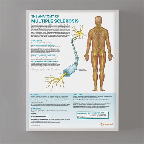 The Anatomy Of Multiple Sclerosis Chart Poster Anatomystuff