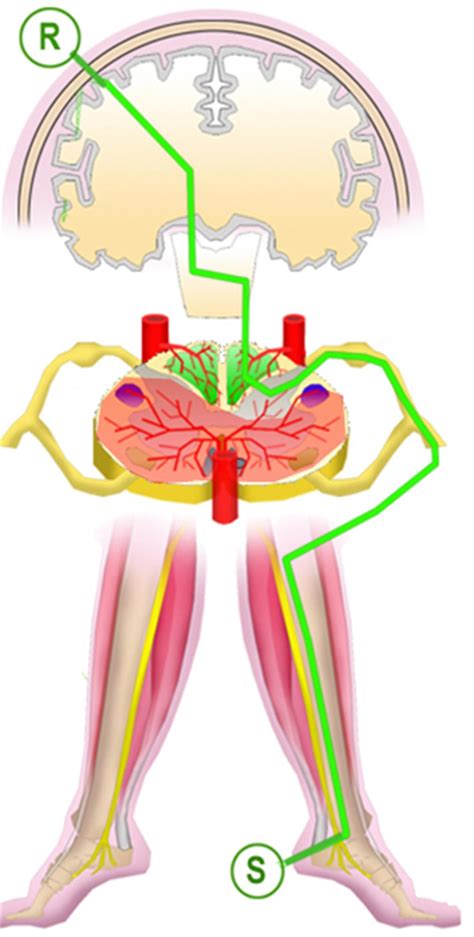 Spinal Cord Monitoring Spine Orthobullets