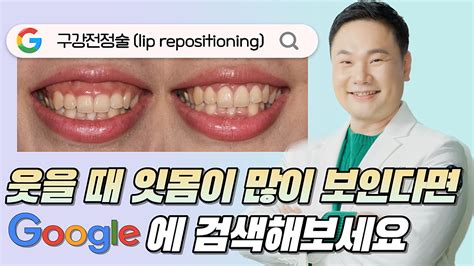 강남역 치과 웃을 때 잇몸이 많이 보여 신경쓰인다면 필수시청 안보면 후회 네이버 Tv