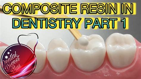 Different Types Of Composite Resin At Lois Lanning Blog