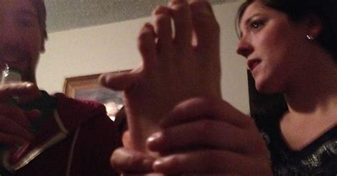 Stubbed My Toe My Girlfriend Was A Little Freaked Out Dan Was Having A Great Time Though Imgur