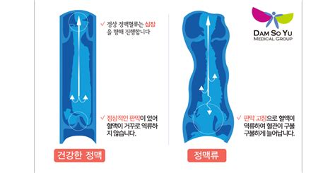 하지정맥류클리닉 담소유병원