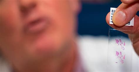 Livmorhalskreft Må Vente 98 Dager På Viktig Prøvesvar