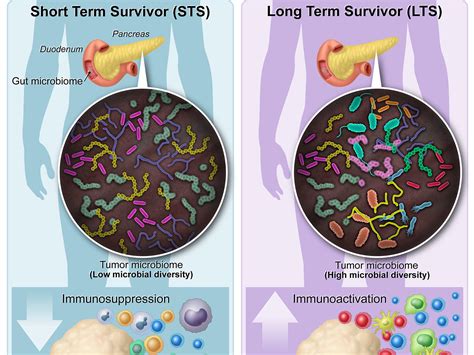 Treating Pancreatic Cancer By Altering The Tumor Microbiome Nci