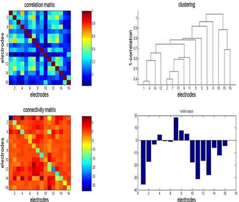 Functional Connectivity In Intracranial Eeg Predicts Surgical Outcome In Intractable Temporal