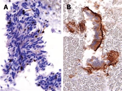 Spindle Cells Of Gastric Gastrointestinal Stromal Tumour Documented Download Scientific Diagram