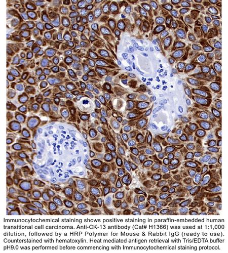 Anti Ck 13 Rabbit Monoclonal Ab H1366 Genuin Biotech