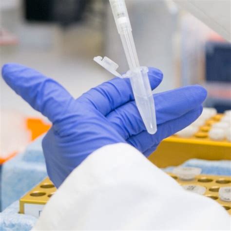 Pbmc Protocol Bruker Cellular Analysis Pbmc Protocol Bruker Cellular Analysis