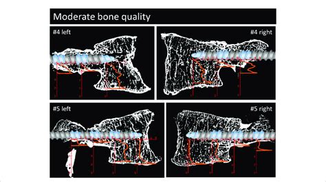 Continuation Of Figure 3 Parasagittal Reconstruction Of The Micro Ct Download Scientific