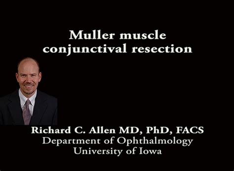 Muller Muscle Conjunctival Resection