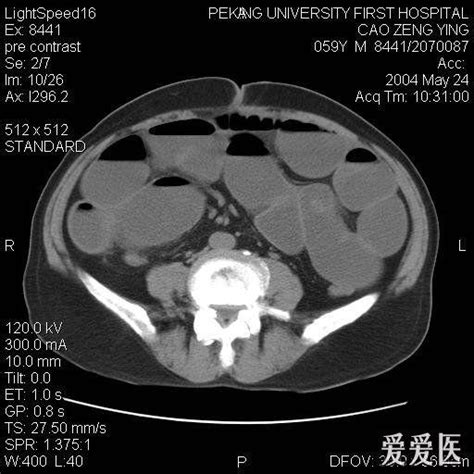 ct照片全身 千图网