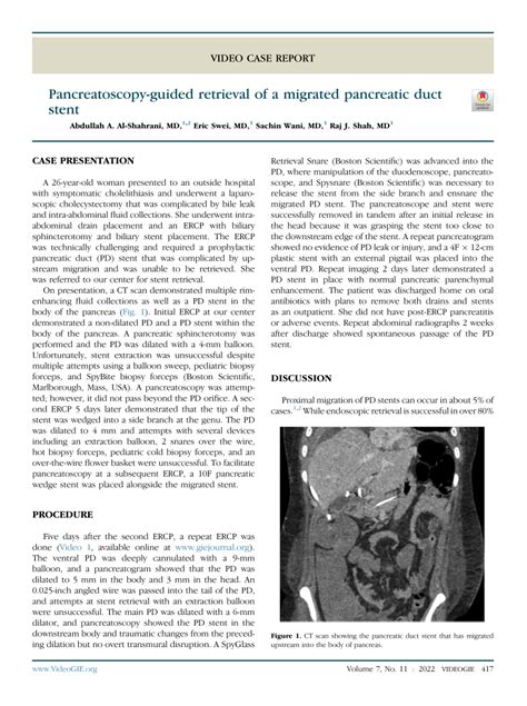 Pdf Pancreatoscopy Guided Retrieval Of A Migrated Pancreatic Duct Stent