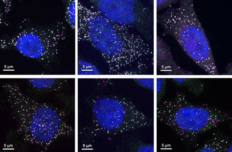 Fmi Article Translating An Rna Boosts Its Degradation