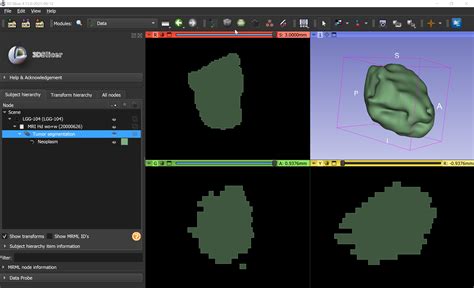 How To Open Multi Frame Dicom Usage And Issues Imagesc Forum