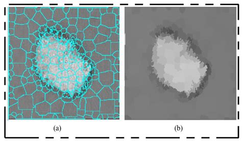 Skin Lesion Segmentation And Multiclass Classification Using Deep Learning Features And Improved
