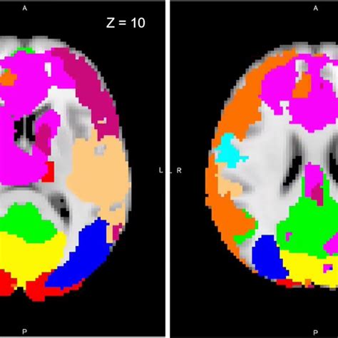 Resting‐state Functional Magnetic Resonance Imaging Network Maps