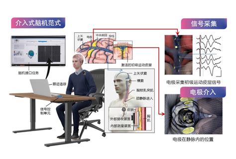 伟思医疗：锚定人工智能脑机接口应用赛道！神经电生理信号 大脑电图记录 激光射频传感器 骨骼机器人！ 财富号 东方财富网
