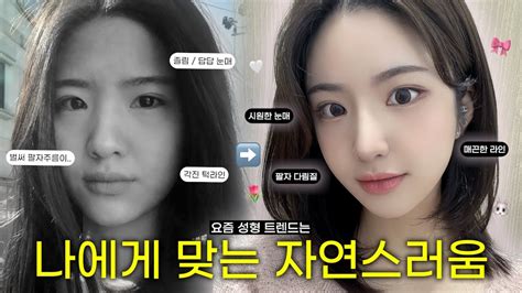 눈이랑 눈썹 가까우면 이렇게 성형해야 함 눈재수술코재수술윤곽3종이마거상실리프팅 Youtube