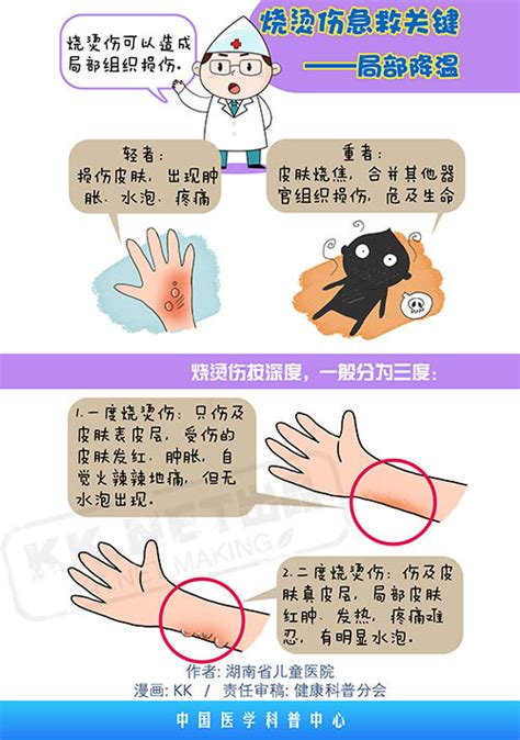 烧烫伤的急救方法 开水烫伤急救方法是什么