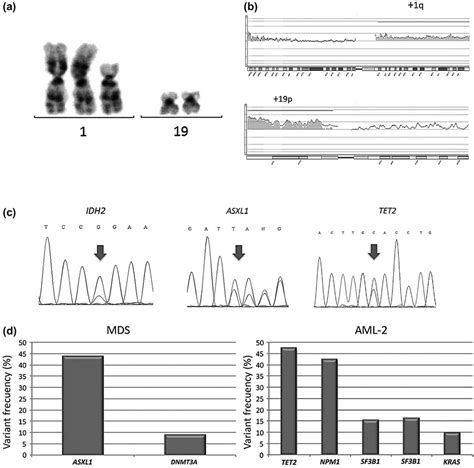 Genetic Features Detected By Gtg Banding Technique Array Cgh And