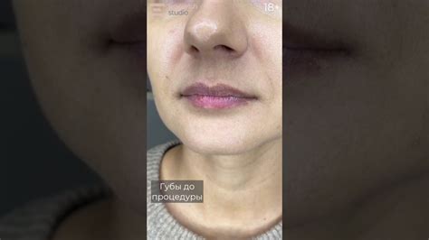Перманент губ В конце заживший результат До и после перманент губы Shorts татуаж допосле