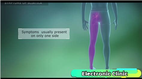 Human Posture Monitoring Using Flex Sensor Arduino Biomedical Project