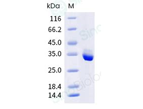 Recombinant Mouse Complement Component 3 Protein 56999 M08H Sino Biological