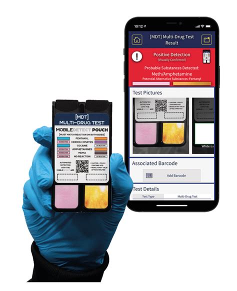 MSD Mobile Detect Miprotek