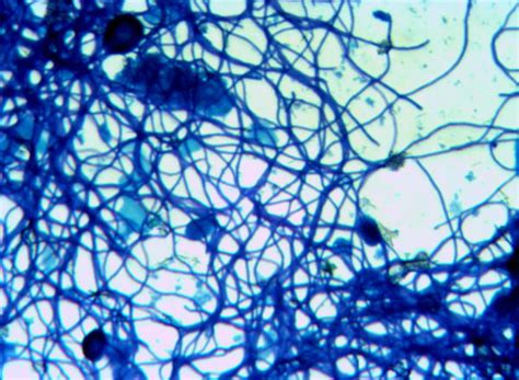 Streptomyces Avermitilis