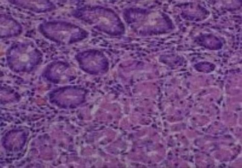 Novus Biologicals Human Multi Tissue Tissue Microarray Cancer Human Ovary Fisher Scientific