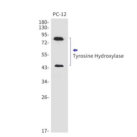 Recombinant Rabbit Monoclonals Assayvector