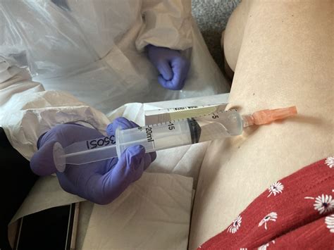 Phesgo Injection Macmillan Online Community